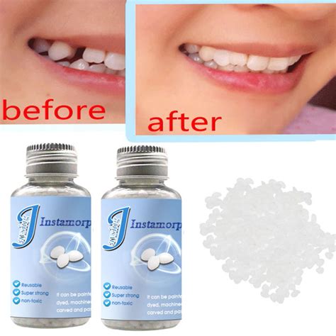 Dsfvasd Safety Decorative Denture Repair Dental False Teeth Solid Glue