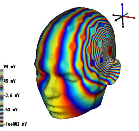 Comparison Of Potential Distributions In Combined Eeg And Tes