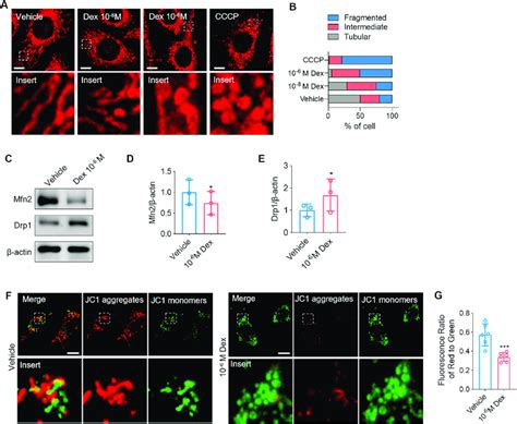 gc causes increased mitochondria fission and membrane potential