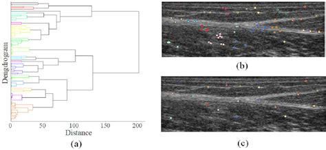 Figure 4 From Automatic Myotendinous Junction Identification In Ultrasound Images Based On
