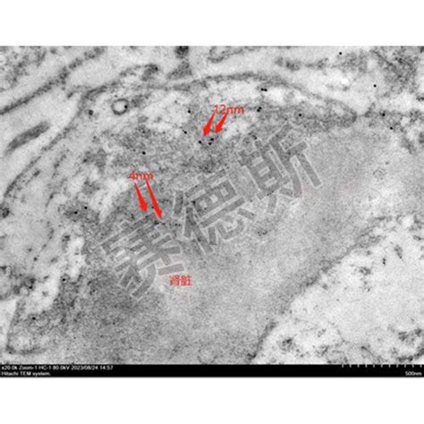 免疫电镜 实验代做病理分子细胞基因合肥赛德斯生物科技有限公司