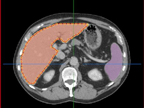 nvidia clara train and deploy brings new features to medical imaging