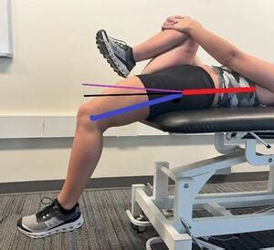 Reliability Of Goniometric Techniques For Measuring Hip Flexor Length
