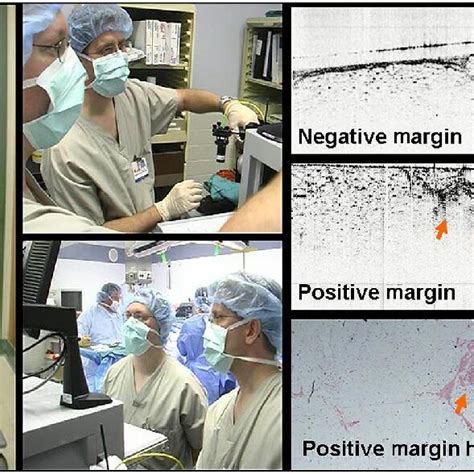 Third Generation Intraoperative Portable Oct System And Handheld Probe Download Scientific
