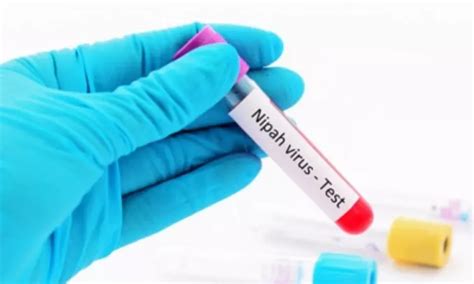Nipah Can Spread By Droplets Has A Fatality Rate Of 40 To 70 Icmr