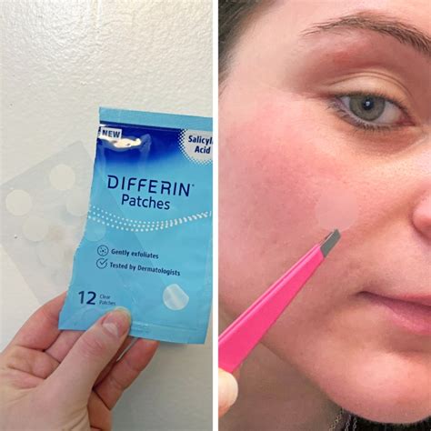 15 Best Pimple Patches Of 2025 Tested And Reviewed Nbc Select