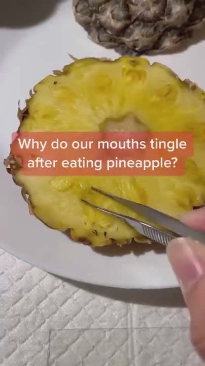 Sujit Dolai On Linkedin Have You Ever Wondered Why Your Tongue Feels