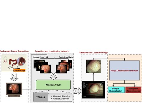 Attention Guided Deep Framework For Polyp Localization And Subsequent Classification Via Polyp