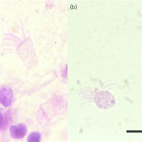 Morphological Differences Between Cytoplasmic Fragments Of Ciliated