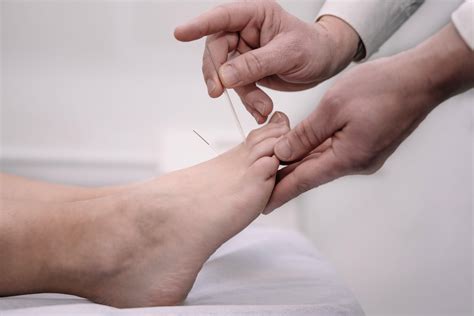Diabetic Neuropathy Nerve Damage Symptoms And Treatment