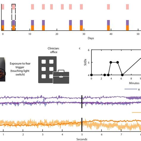 Anatomical Localization Of Dbs Lead Placement P1 P2 P3 P5 A B Download Scientific