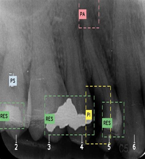 end to end ai adoption for early stage dental diagnostics startup big