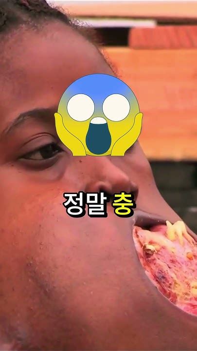 이 불쌍한 여성의 거대한 종양이 제거되었습니다 😰😭 Youtube