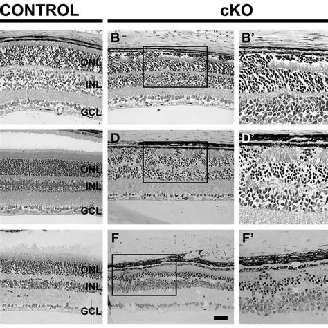 Immunohistochemistry Pictures From P10 Mouse Retinae Retina Sections