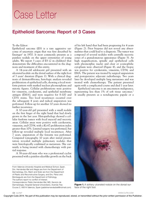 Pdf Epithelioid Sarcoma Report Of 3 Cases