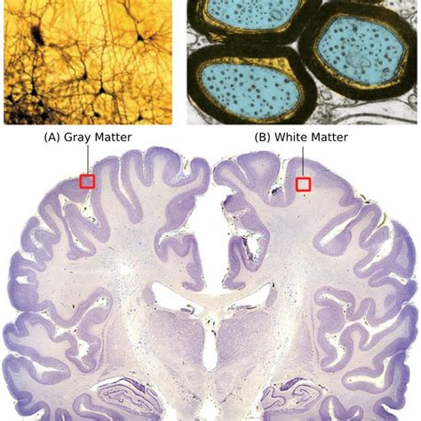 3 The Cerebral Cortex Is Divided Into More Than 50 Regions Based On Download Scientific