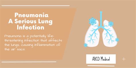 Pneumonia A Serious Lung Infection