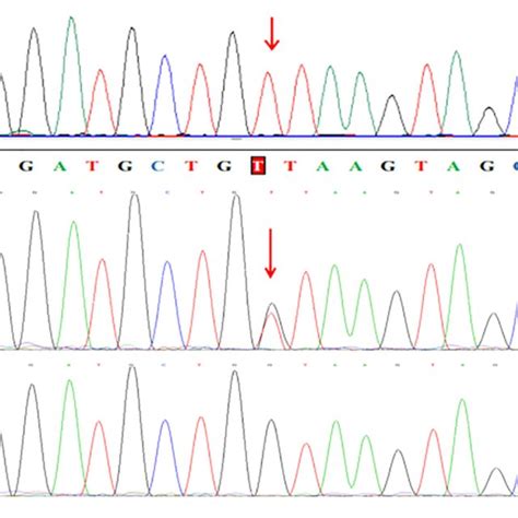 Partial Sequence Chromatograms Of Vps13b The Red Arrows Represent Download Scientific