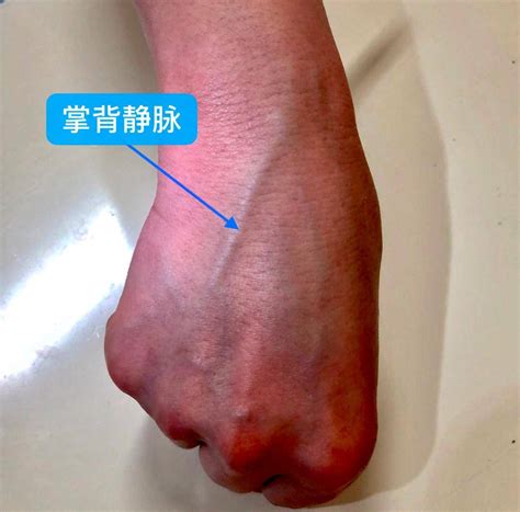 争议采血管抽血顺序到底哪个先哪个后一文搞定静脉采血 8 大问题 搜狐大视野 搜狐新闻