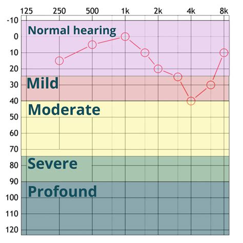 Understanding Normal Discrimination Scores A Guide To Hearing Health