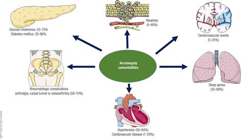 Scielo Brasil Acromegaly In The Elderly Patient Acromegaly In The