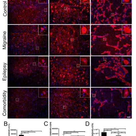 Localization Of Tlr4 In The Temporal Cortex Medullary Dorsal Horn And