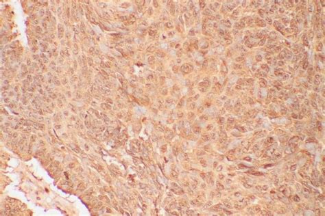 Background Staining Or Non Specific Binding Of Antibodies In