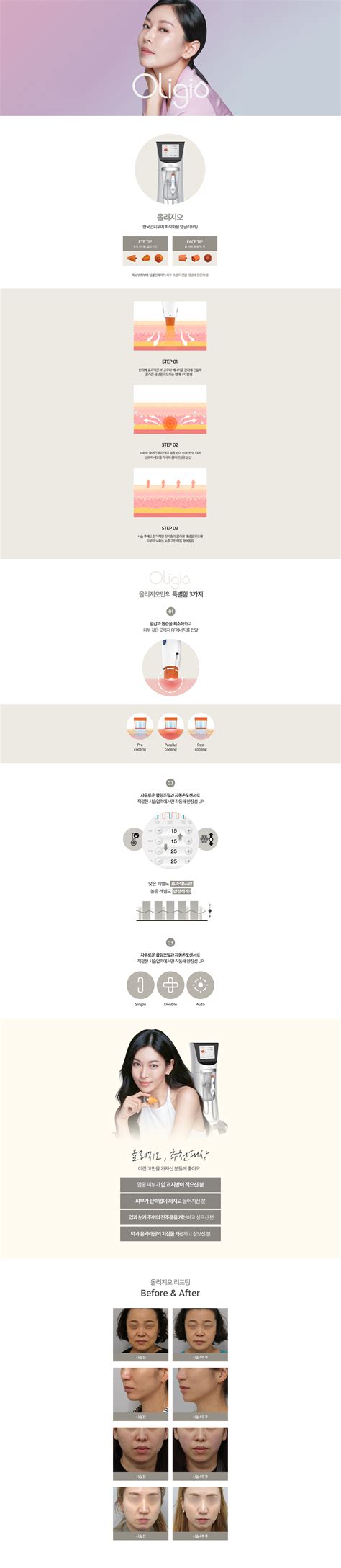 올리지오 제일이쁜느낌 제이필의원 홍대 피부과 리프팅 전담병원울쎄라 인모드 슈링크 올리지오 필러 장인 스킨부스터리쥬란힐러 엑소좀맛집