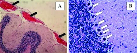 The Histopathological Images Of Group 1 In The Cerebellum Tissue A