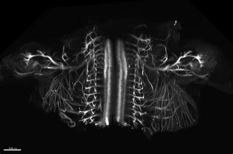 Visualization Of Motor Axon Navigation And Quantification Of Axon Arborization In Mouse Embryos