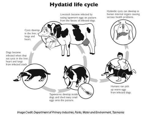 Hydatid Cysts Of The Liver Liver Doctor