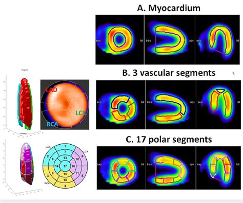 Three Cardiac Segmentation Methods Three Methods Of Segmentation Were