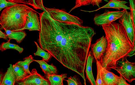 A Brief History Of Live Cell Imaging Labtag Blog