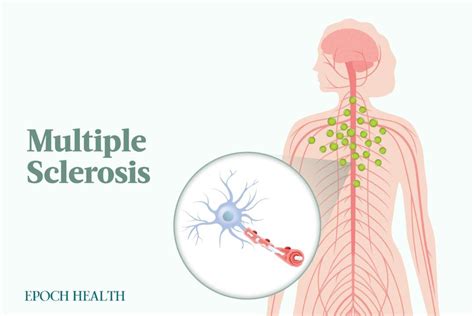 Central Nervous System The Epoch Times
