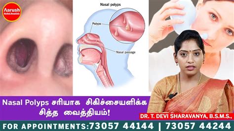 Nasal Polyps மூக்கில் சதை வளர்ச்சி சரியாக சிகிச்சையளிக்க சித்த