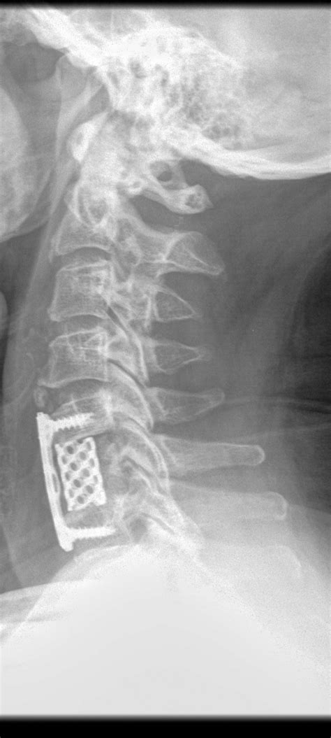Galeria Neurochirurg Poznań Tomasz Blok