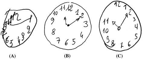 Printable Clock Drawing Test Printable Word Searches