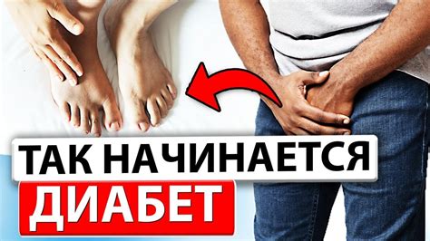 Ещё не Диабет но 4 признака высокого сахара и Как предотвратить
