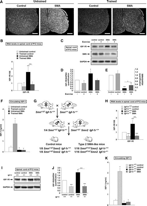 IGF R Reduction Triggers Neuroprotective Signaling Pathways In Spinal Muscular Atrophy Mice