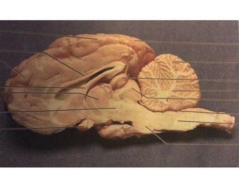 Sagittal Sheep Brain Quiz