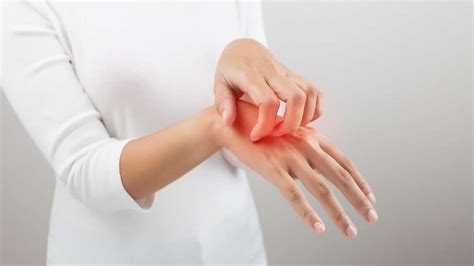Top Ten Common Skin Spots Advanced Dermatology Of The Midlands