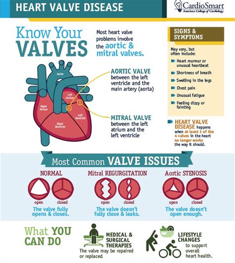 American College Of Cardiology On Linkedin Cardiosmart 13 Comments