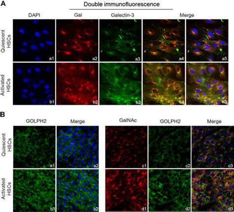 Double Immunofluorescence A The Colocalization Of Gal Binding Download Scientific Diagram