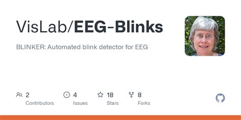 Eeg Blinks Blinker Interface Dlg Blinker M At Master Vislab Eeg