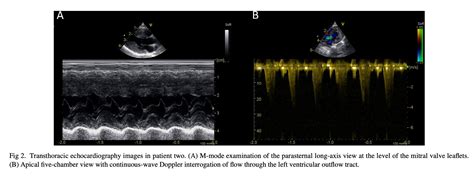 Patient Journal Of Cardiothoracic And Vascular Anesthesia