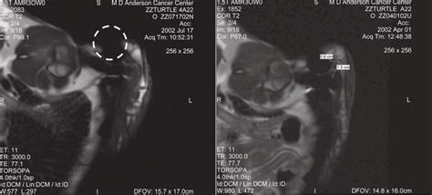 A A Dorsoventral Plane Mri Scan Of The Left Turtle Flipper And Download Scientific Diagram A A Dorsoventral Plane Mri Scan Of The Left Turtle Flipper And Download Scientific Diagram