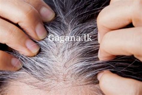 සුදු කෙස් නිසා ඇත්තටම සිත් තැවුලෙන් ද හිටියේ සුදු කෙස් විනාඩි 5න් නැති කරන විශ්මිත දේශීය