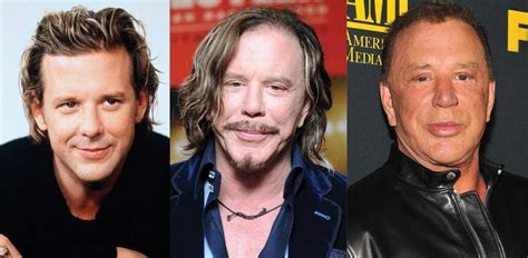 Mickey Rourke Plastic Surgery Before And After