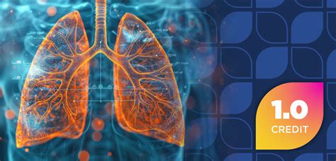 Acip Votes To Recommend Pneumococcal 21 Valent Conjugate Vaccine For