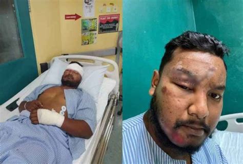 Ceo Batu Terlibat Kemalangan Terima Lebih 20 Jahitan Astro Awani